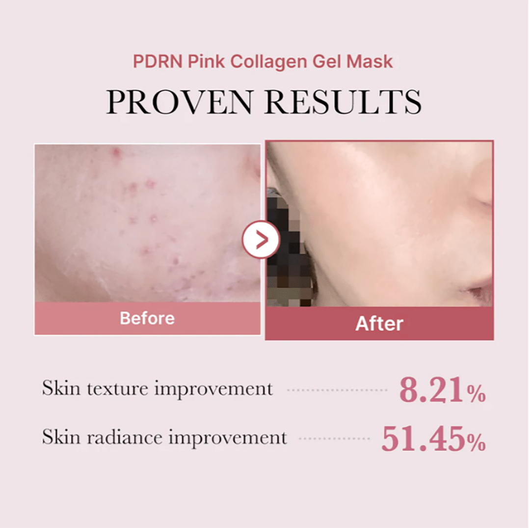 PDRN Pink Collagen Gel Mask – MEDICUBE MY